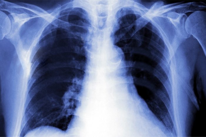 Which types of X-rays & scans have the most radiation? - Qoctor, the ...